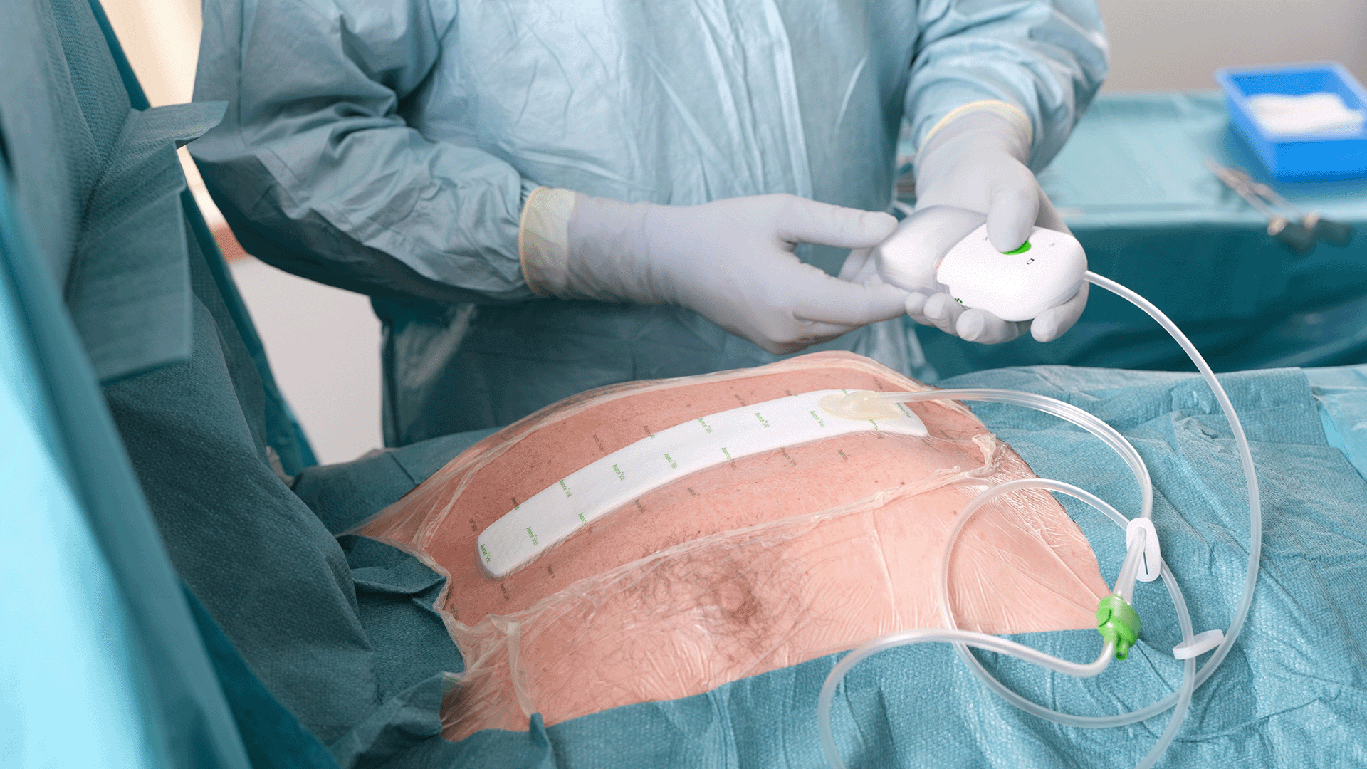 How to use Avance Solo - Professionals